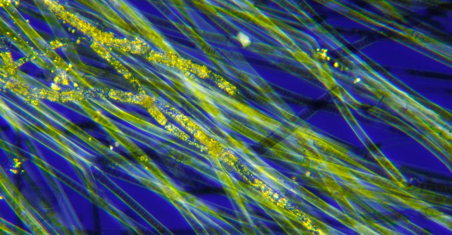 Des « algues bleues » pour alimenter nos montres connectées : une ...