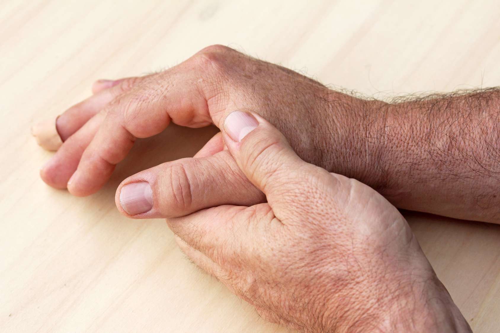 Définition | Substance noire - Locus niger - Substantia nigra