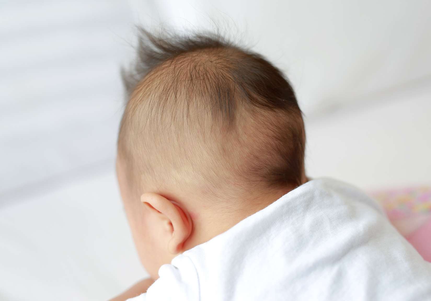 Définition | Craniosténiose - Craniosynostose