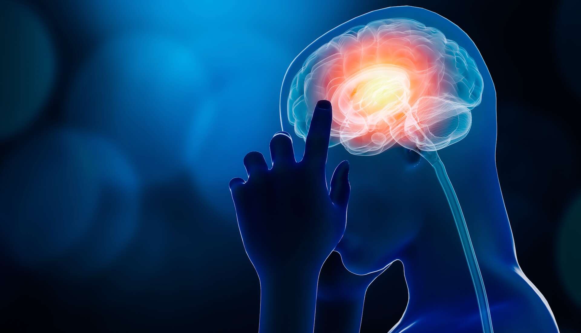 Man with 'Swimming Pool' of Cerebrospinal Fluid Instead of Brain: A ...