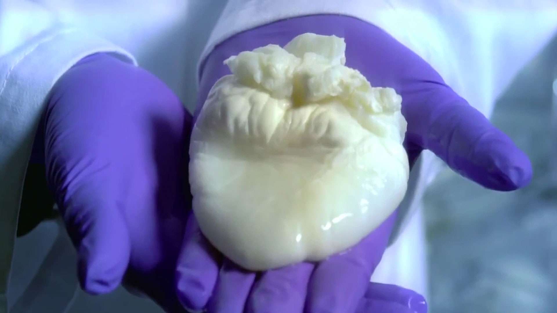 La greffe d’organe révolutionnée par les cellules souches