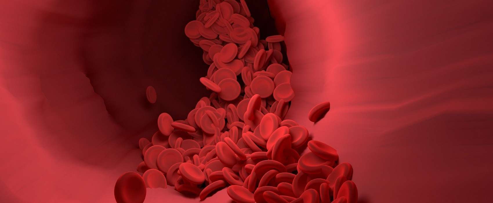 Définition | Leucémie - Cancer du sang