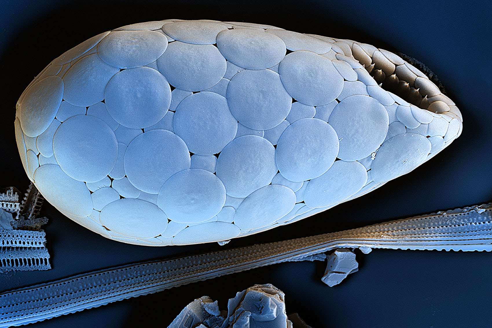 Une amibe dans sa coquille - Photos Futura