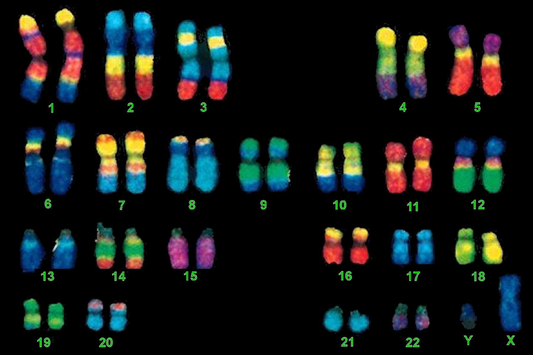 Un caryotype coloré grâce à l'hybridation fluorescente (Fish) - Photos ...