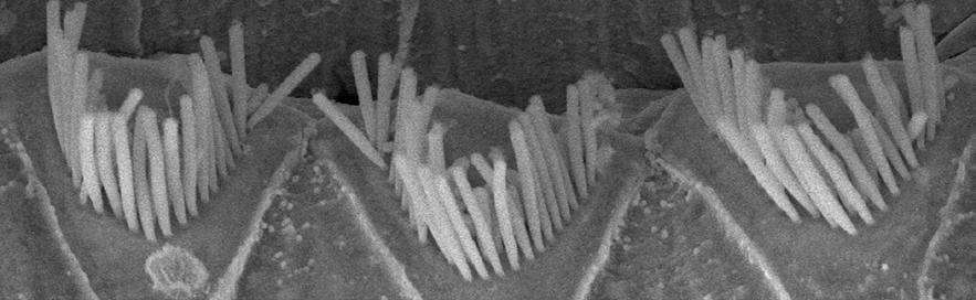 Les cellules ciliées de la cochlée, dans l'oreille interne - Photos Futura