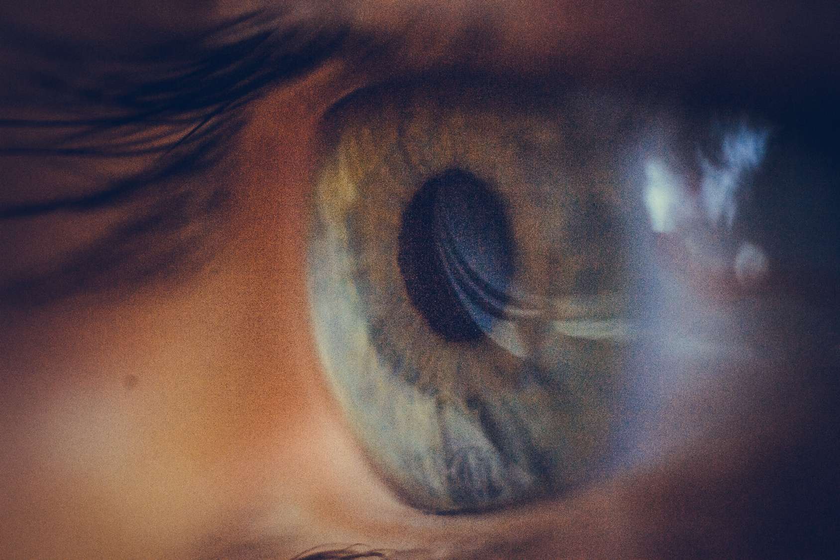 Définition | Décollement de la rétine