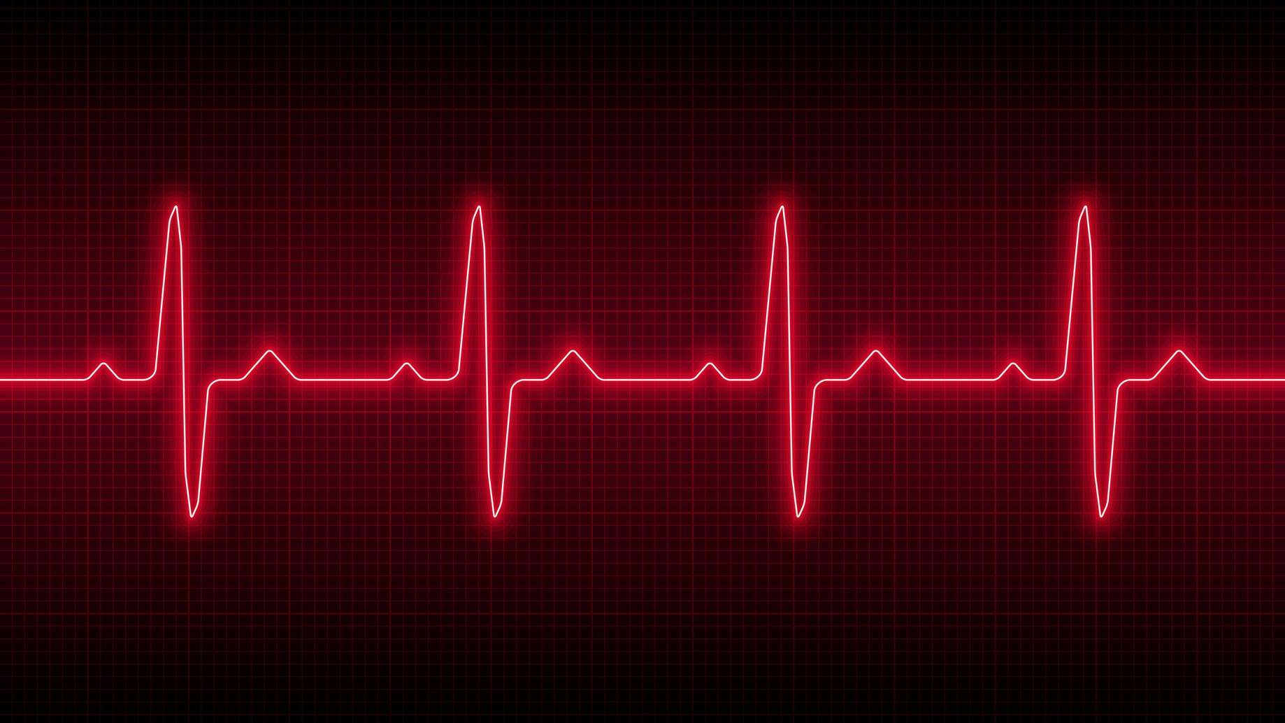 Crise cardiaque : une mutation favorise l'arythmie