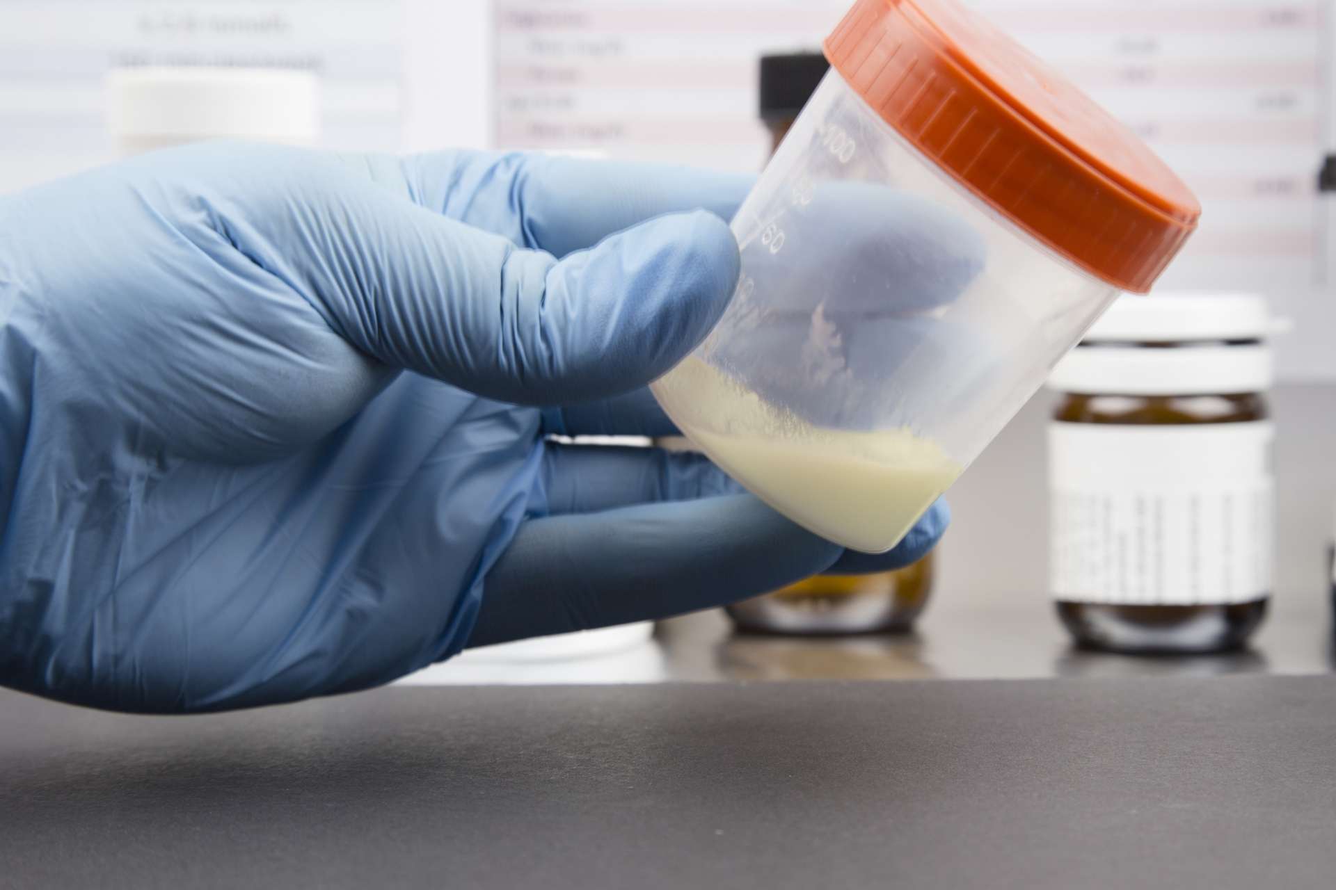 Collecter 66 Imagen Comment Faire Un Spermogramme à La Maison Fr