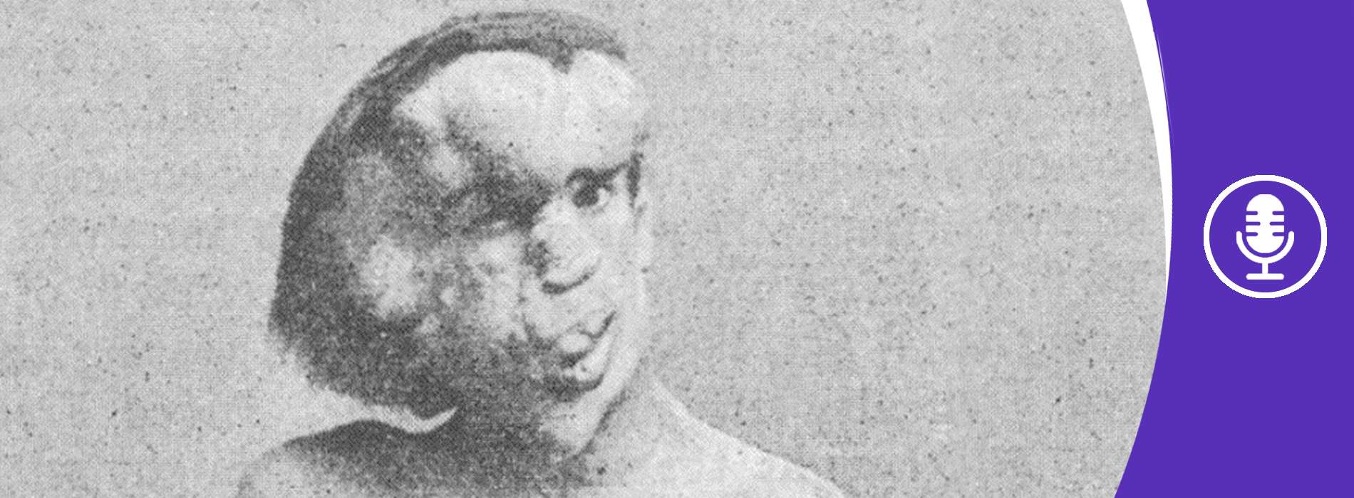 Podcast : Joseph Merrick, ou la véritable histoire d'Elephant Man