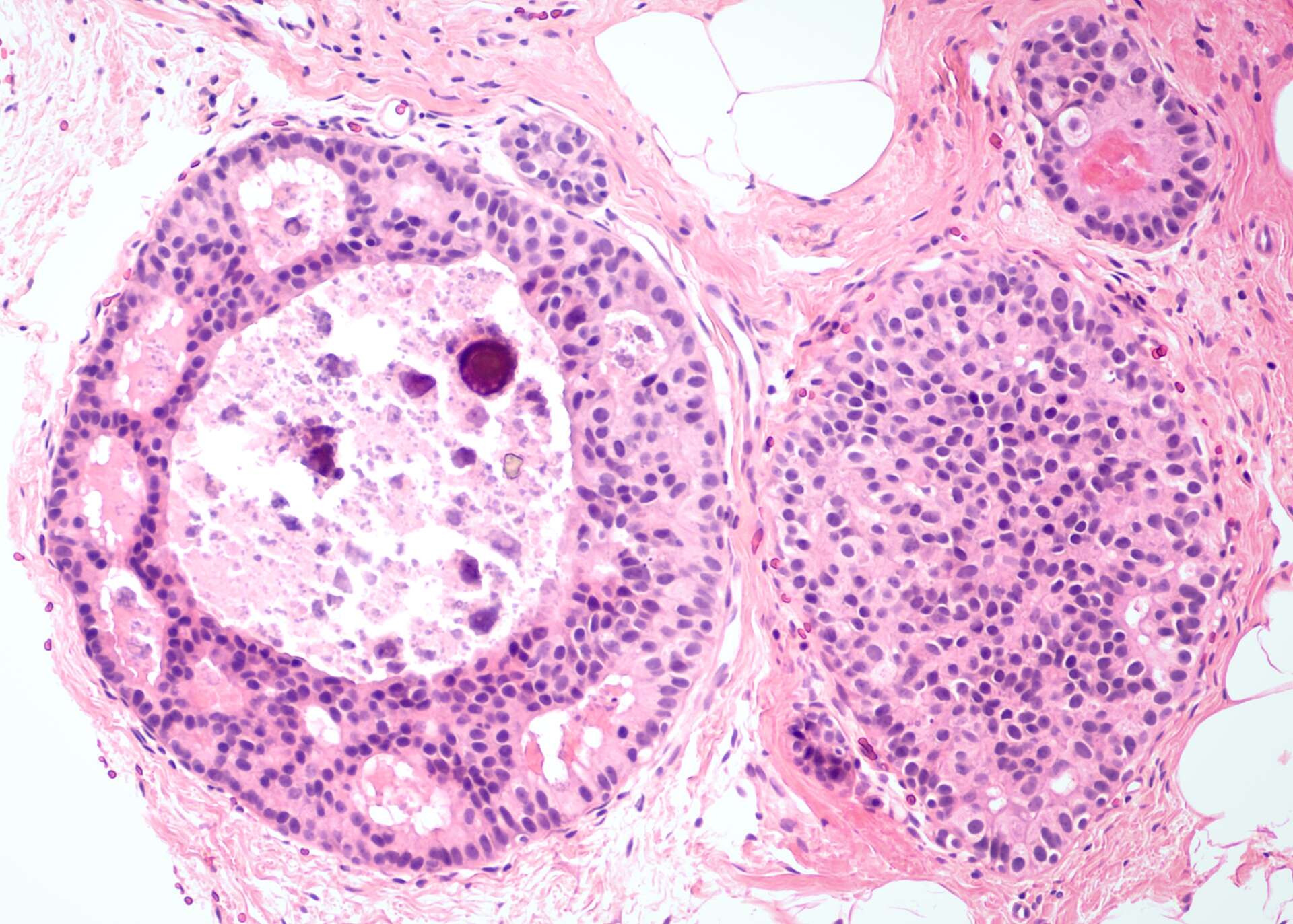 What Is The Medical Term In Situ at Mark Villa blog