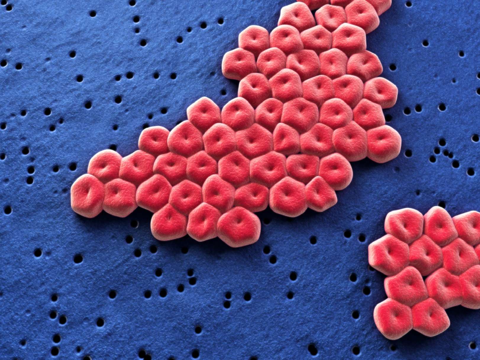 Définition | Acinetobacter