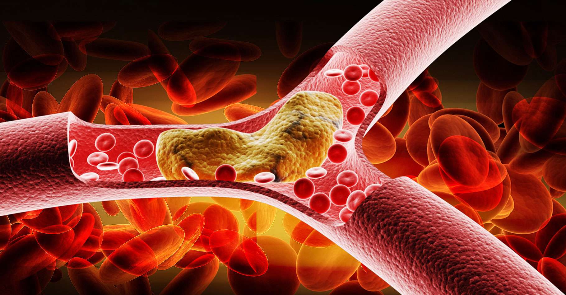 Pour en savoir plus | Dossier