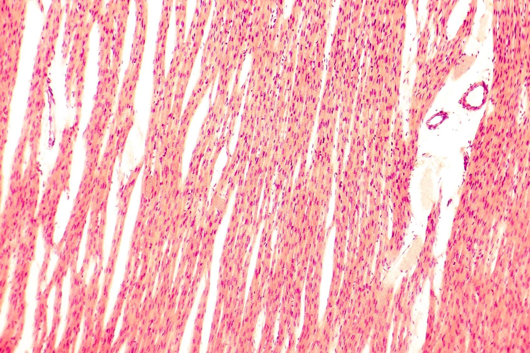 Définition | Cardiomyocyte - Myocyte cardiaque