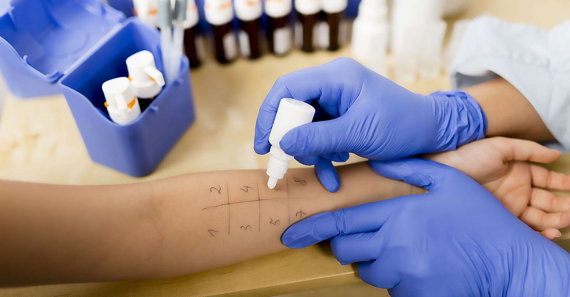 Les allergies de contact | Dossier