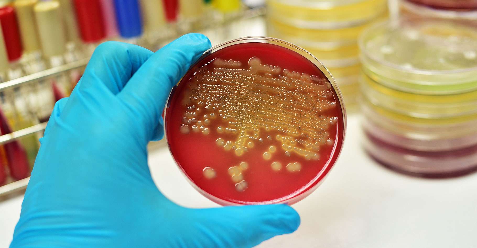 Émile Roux et le vaccin contre la diphtérie | Dossier