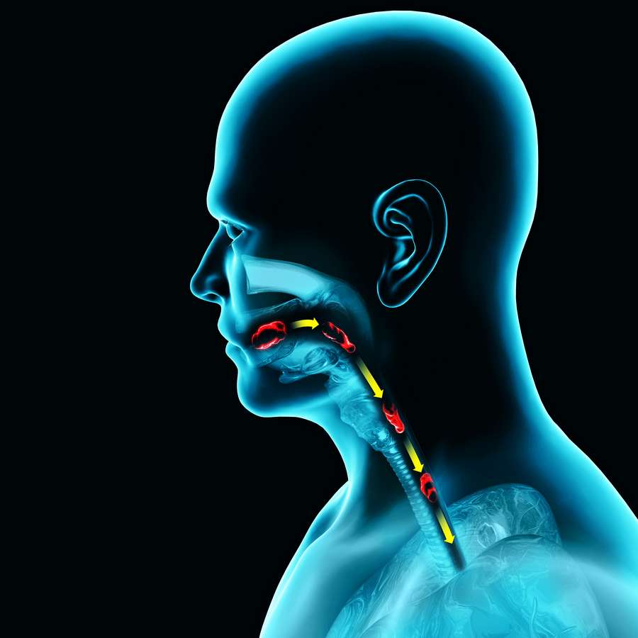 Cancer de l'oesophage | Futura Santé