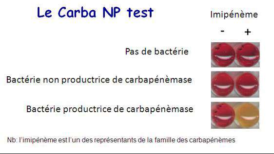 Résistance aux antibiotiques : deux tests diagnostics mis au point