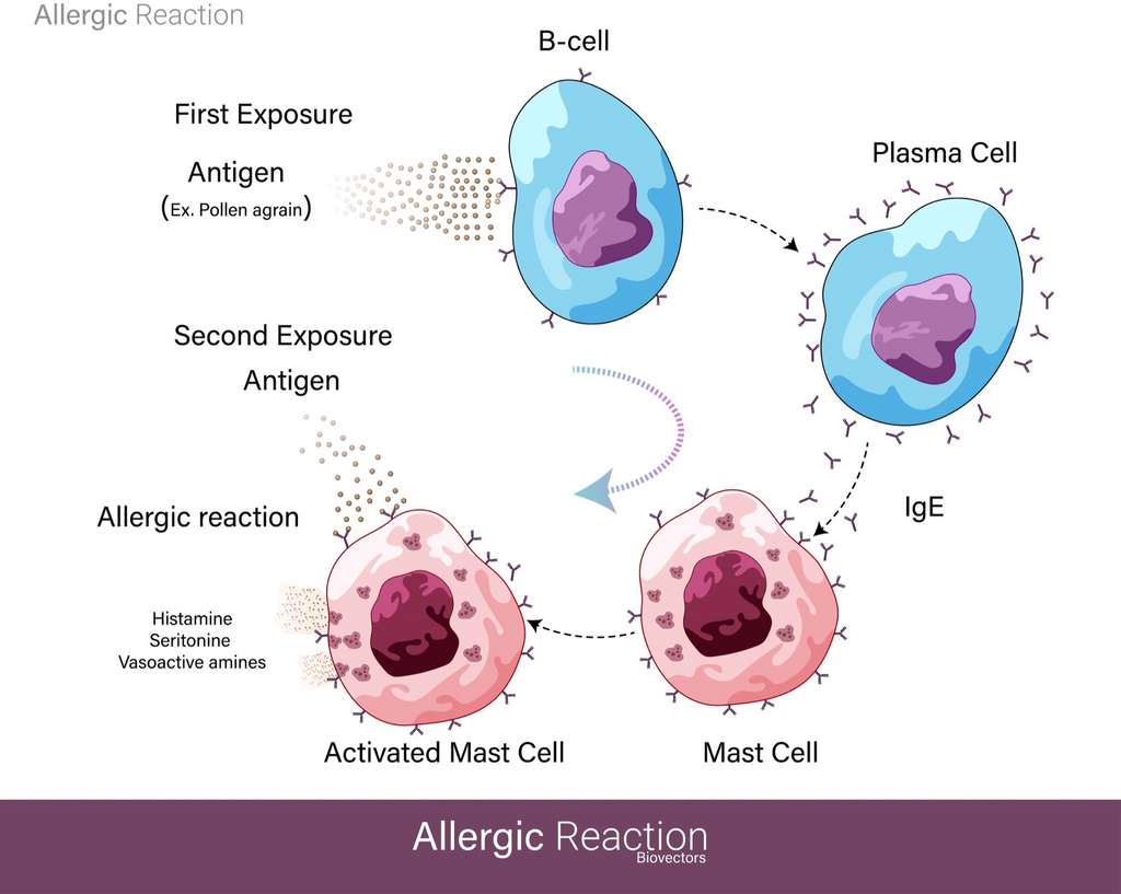 Définition | Syndrome de Skeeter | Futura Santé