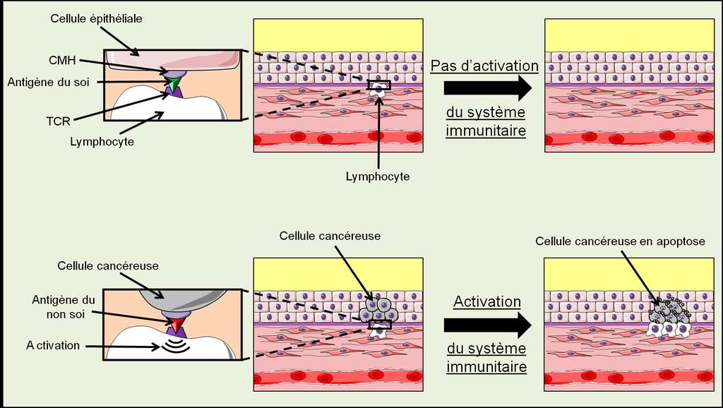 Cancer et système immunitaire | Dossier