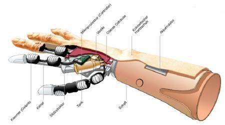Une prothèse de main tout en souplesse
