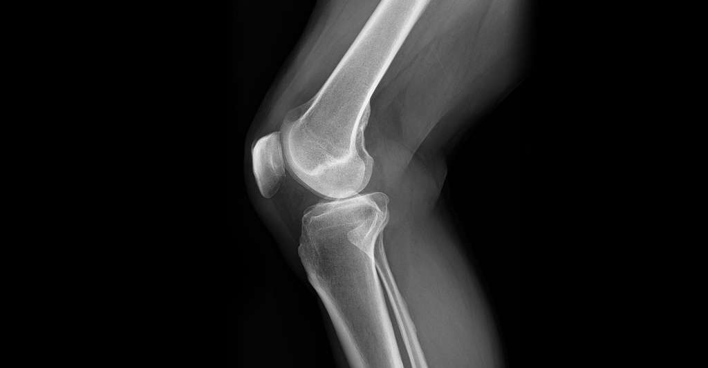 L'anatomie d'une articulation | Dossier