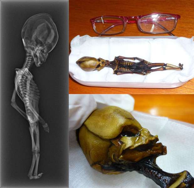 Squelette Ata : non, ce n'est pas celui d'un extraterrestre