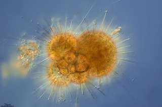 Définition | Protozoaire | Futura Santé