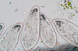 Définition | Protozoaire | Futura Santé