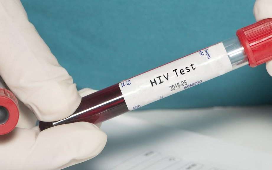 VIH : plus de tests et moins de séropositifs en France en 2018