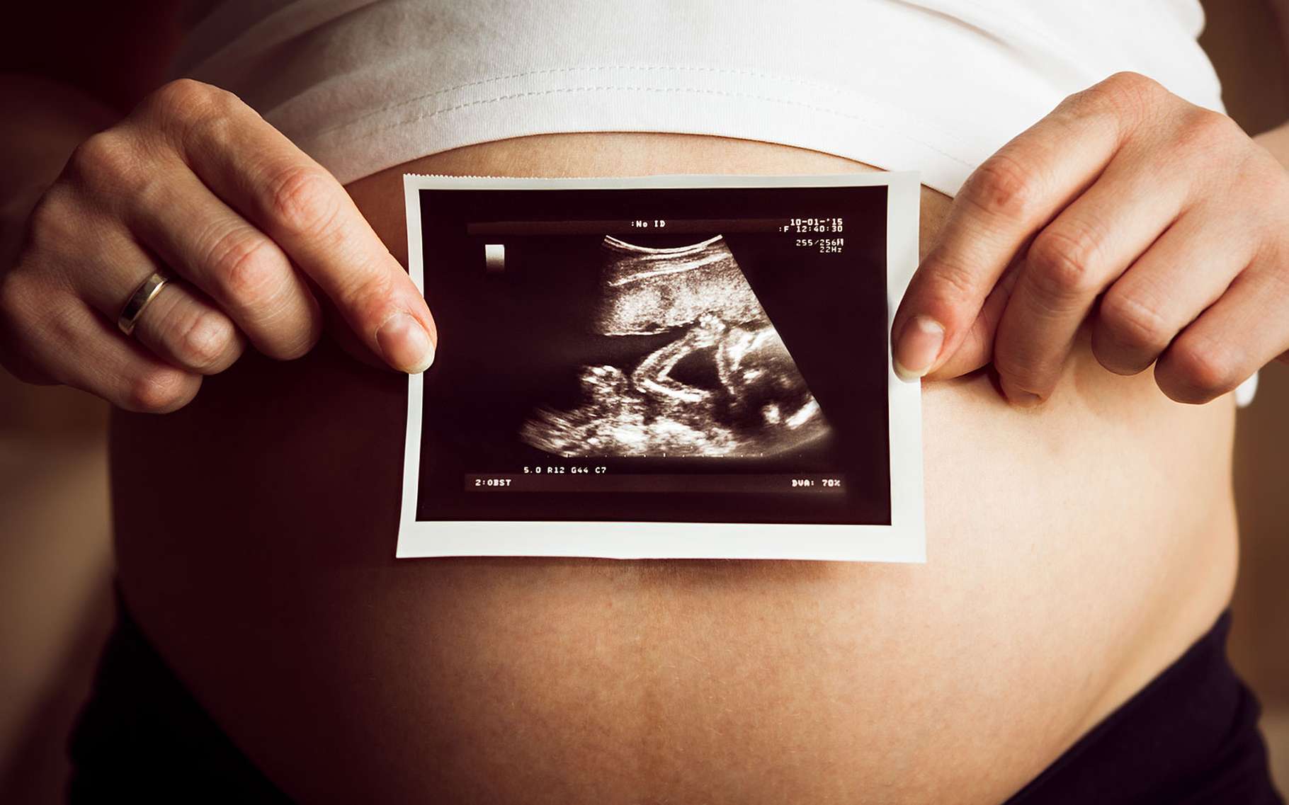 La deuxième échographie de grossesse : l'échographie morphologique ...