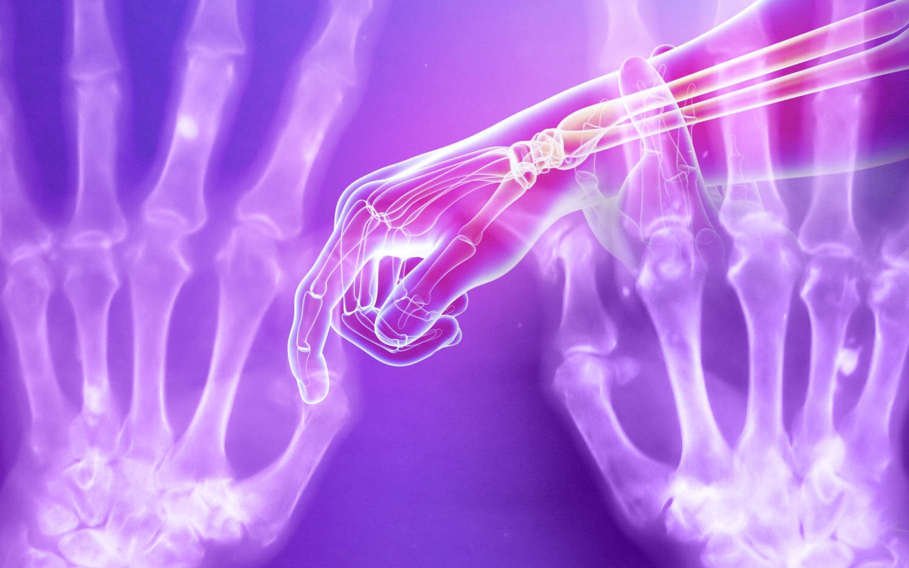 La polyarthrite rhumatoïde, un rhumatisme chronique | Dossier