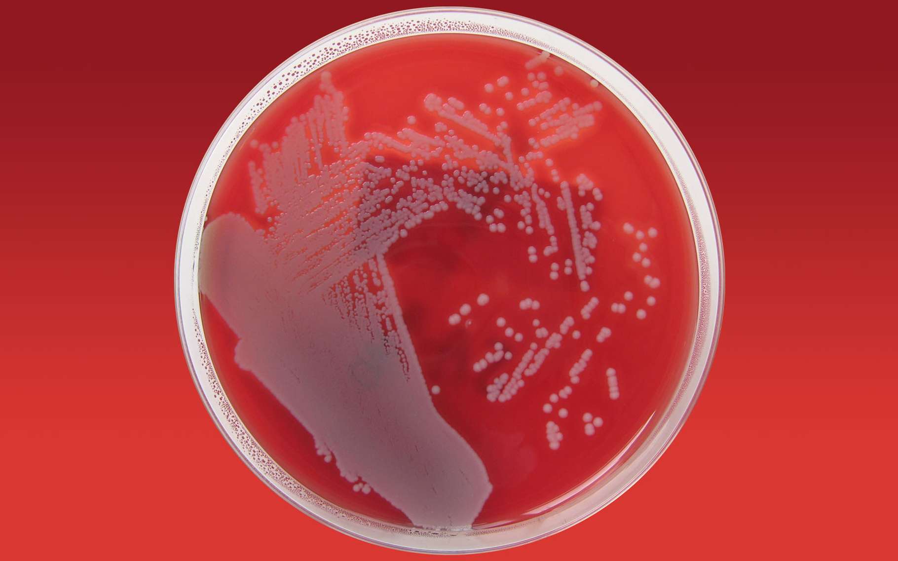 Maladies infectieuses : les TIAC | Dossier