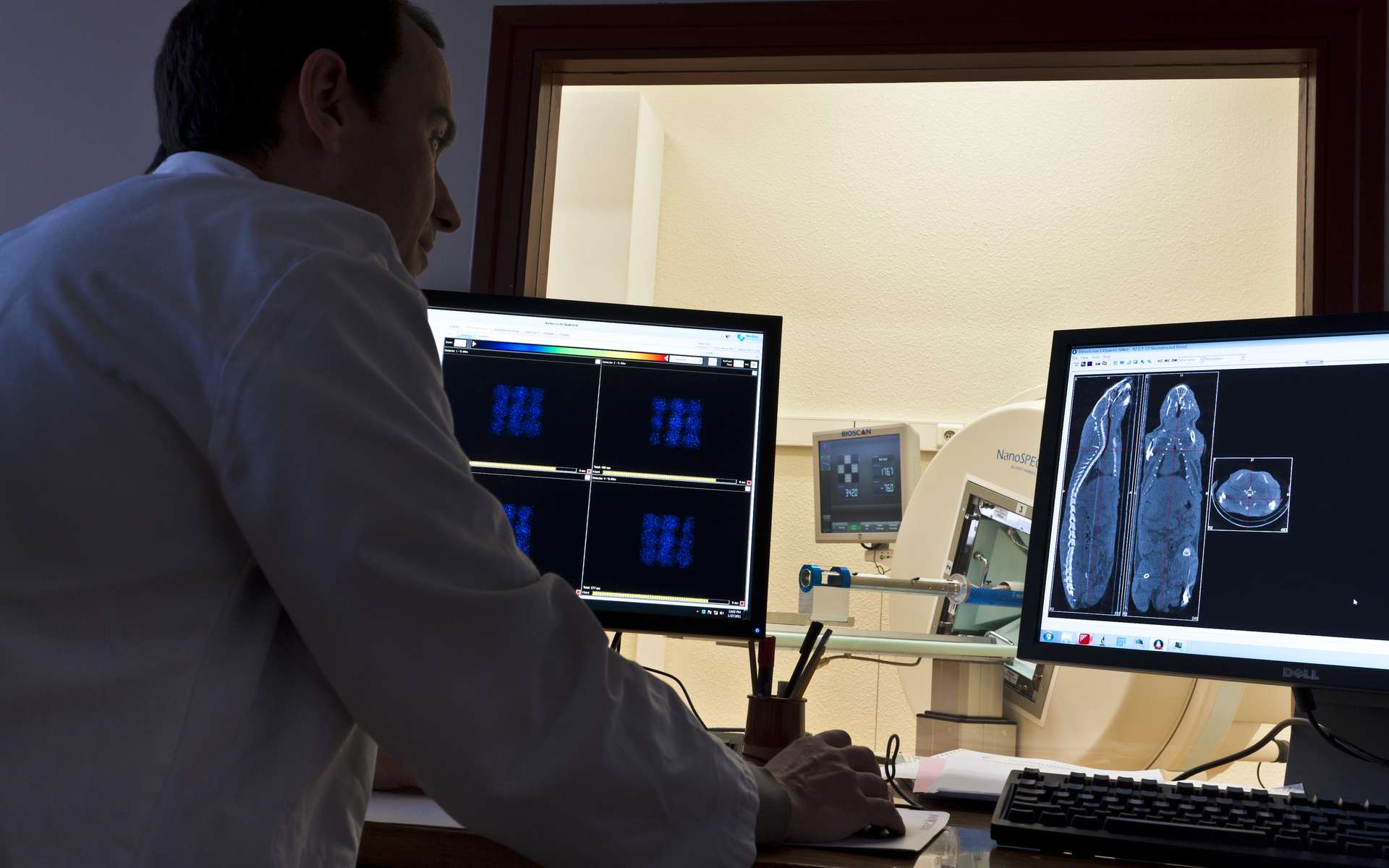 Définition | Arthroscanner | Futura Santé