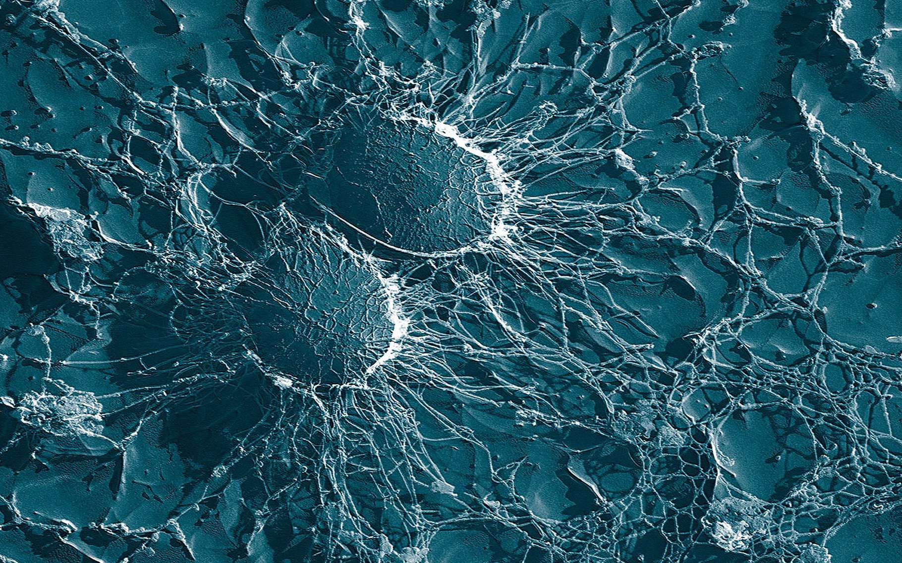 La mycose vaginale, une infection bénigne mais désagréable | Dossier