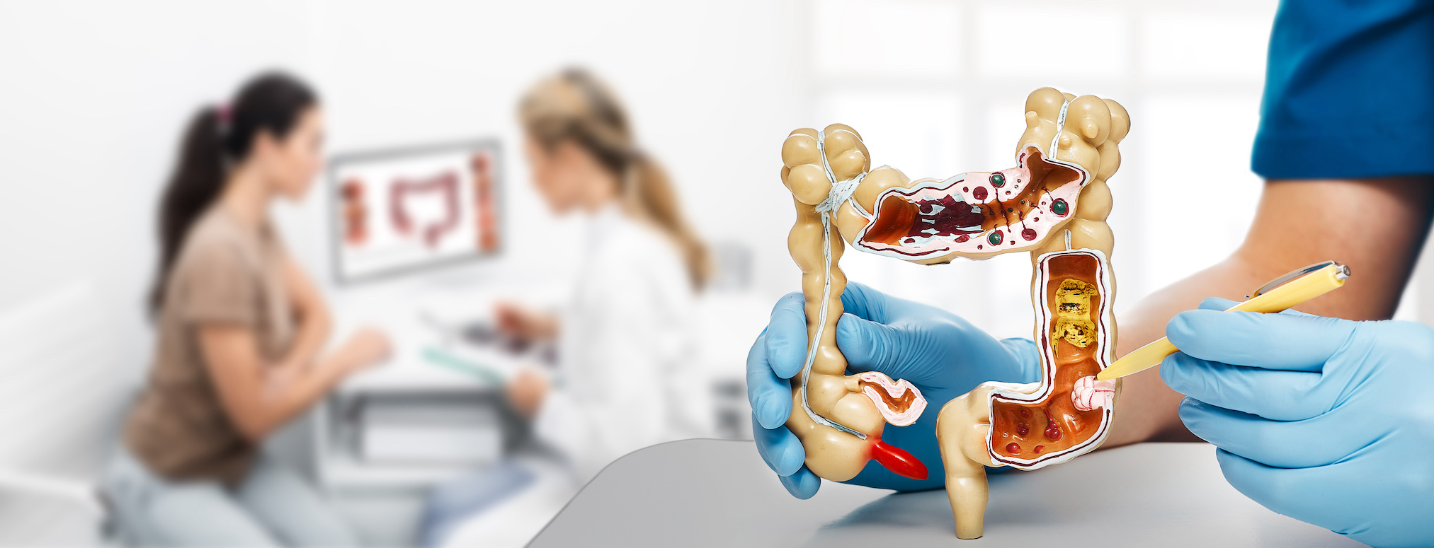 Ce nutriment bien connu pourrait réduire le risque de cancer du côlon ...