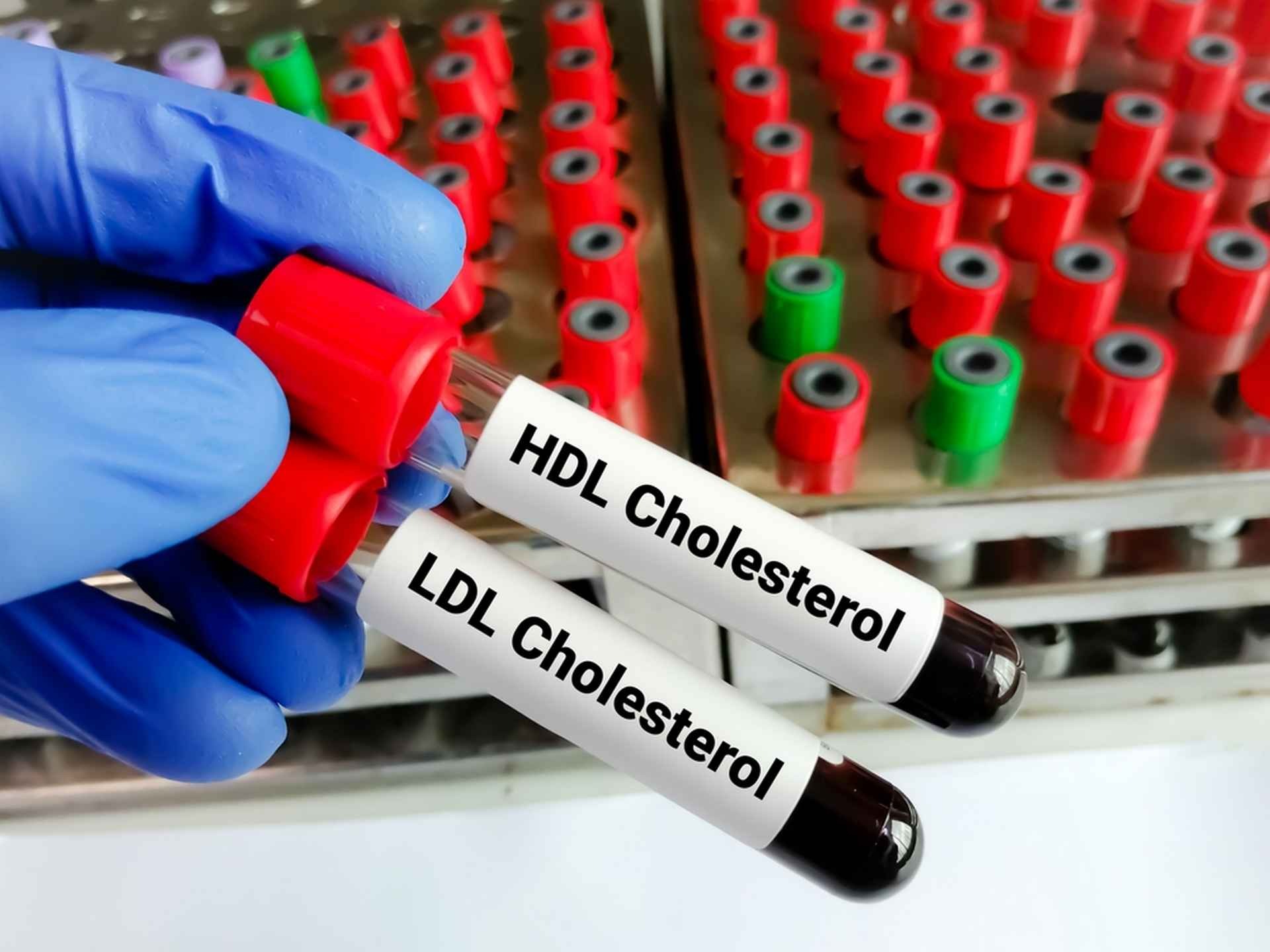 Sitemapcdatahttpwen2windecoocomarterin Cholesterol Nouvelle Formulenull
